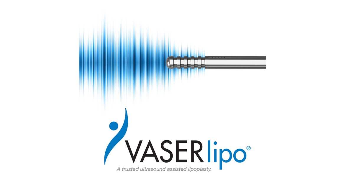 Naples Liposelection