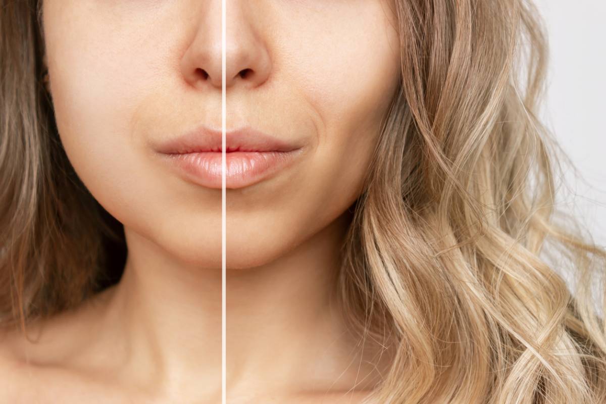 How to Have a Successful Cheek and Chin Surgery Recovery