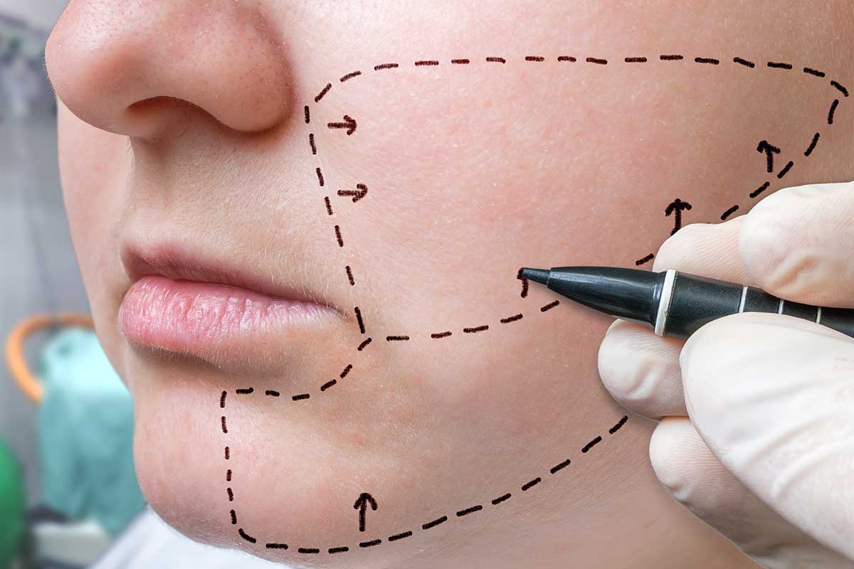 Tips for a Comfortable Cheek and Chin Surgery Recovery - Blog